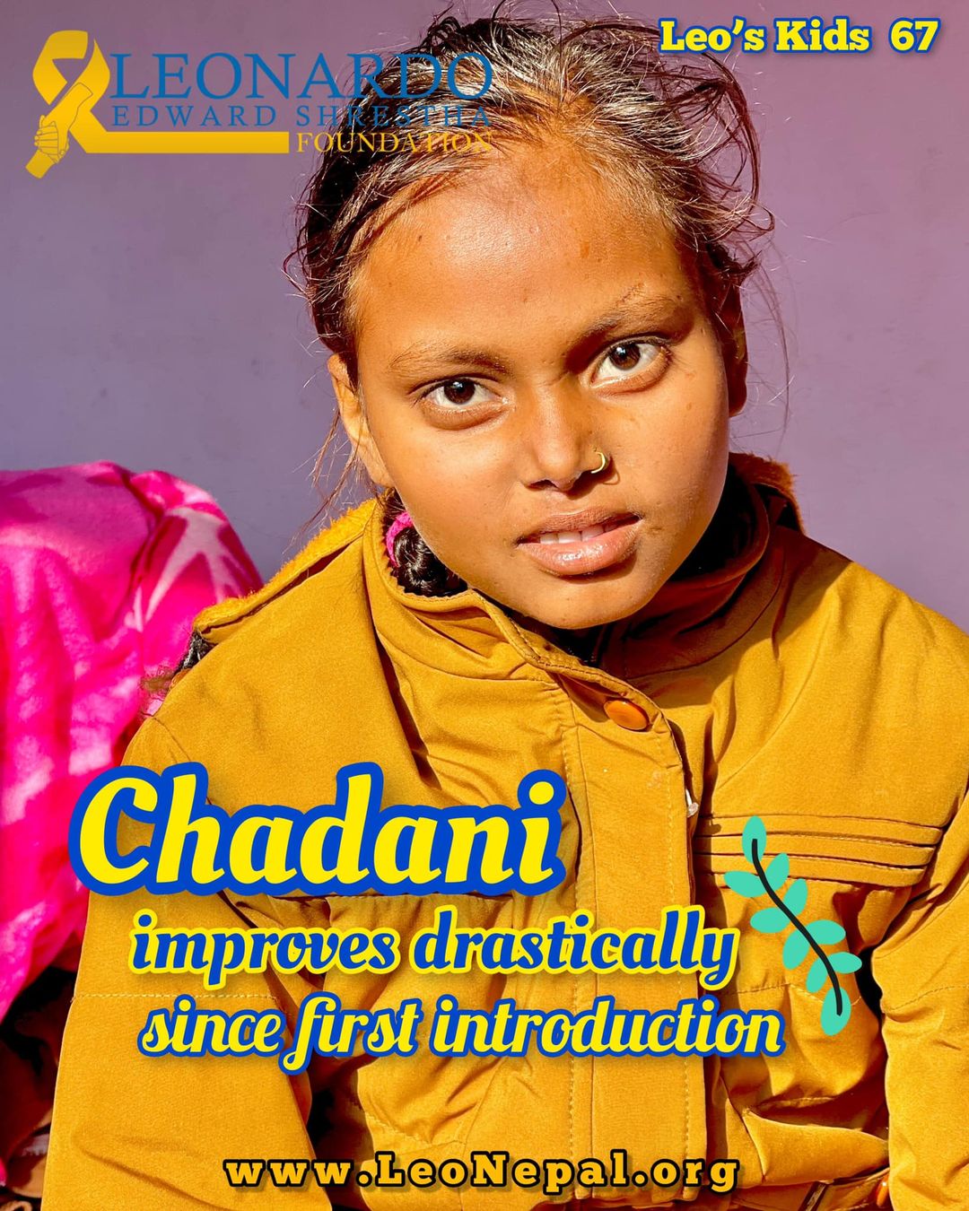 Chadani improves drastically since first introduction | Leonardo Edward ...
